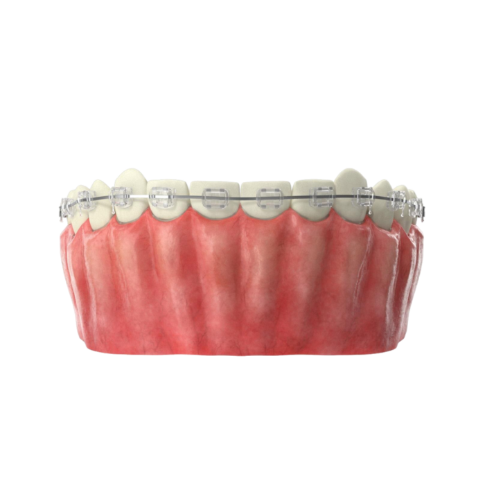 Retainer Price & Type kuala lumpur | Malaysia