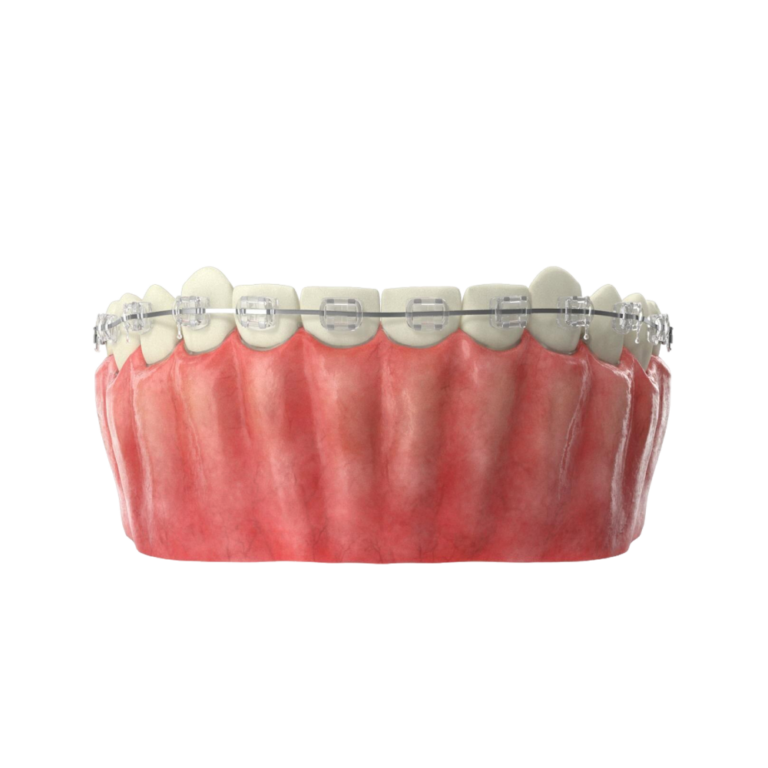 Retainer Price & Type kuala lumpur | Malaysia